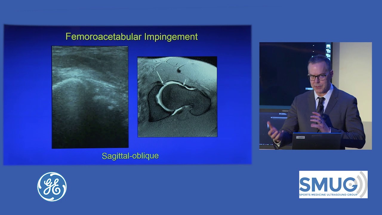 SMUG Jon Jacobson Masterclass 2019. Athletic hip Presentation - YouTube
