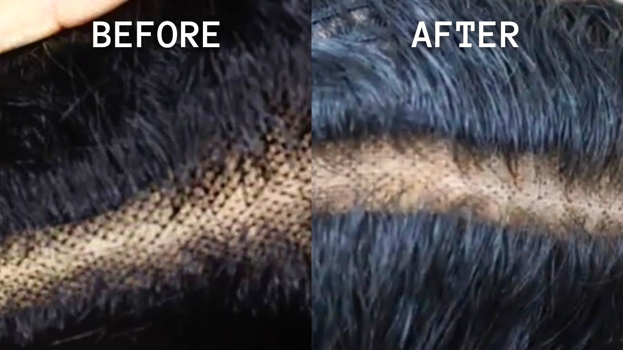 How to: MOST REALISTIC SCALP LIKE WIG EVER! Customize Lace Frontal ...