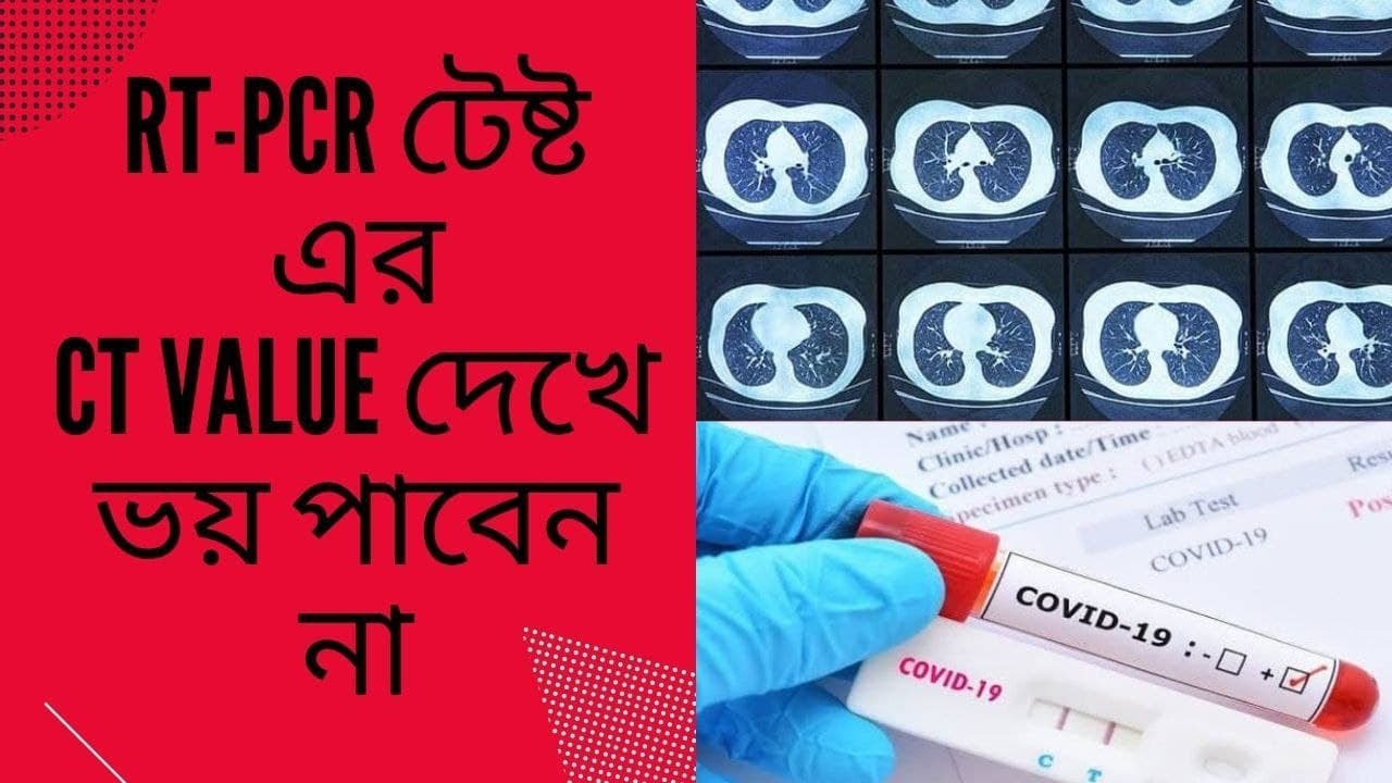 What does CT value on RT-PCR tells? CT value vs CT score - YouTube