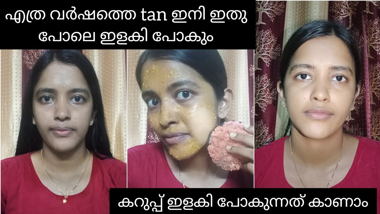 Sun tan permanantly easily remove at home. 💯super home remedy - YouTube