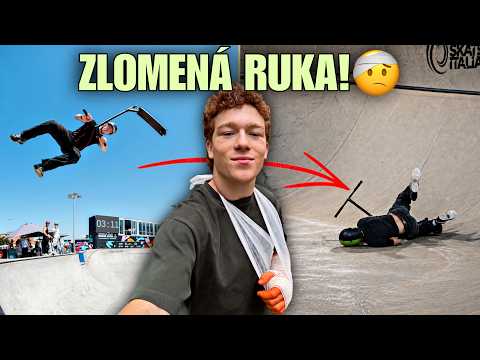 ZLOMIL JSEM SI RUKU NA ZÁVODECH!🤕 Na světovém poháru...