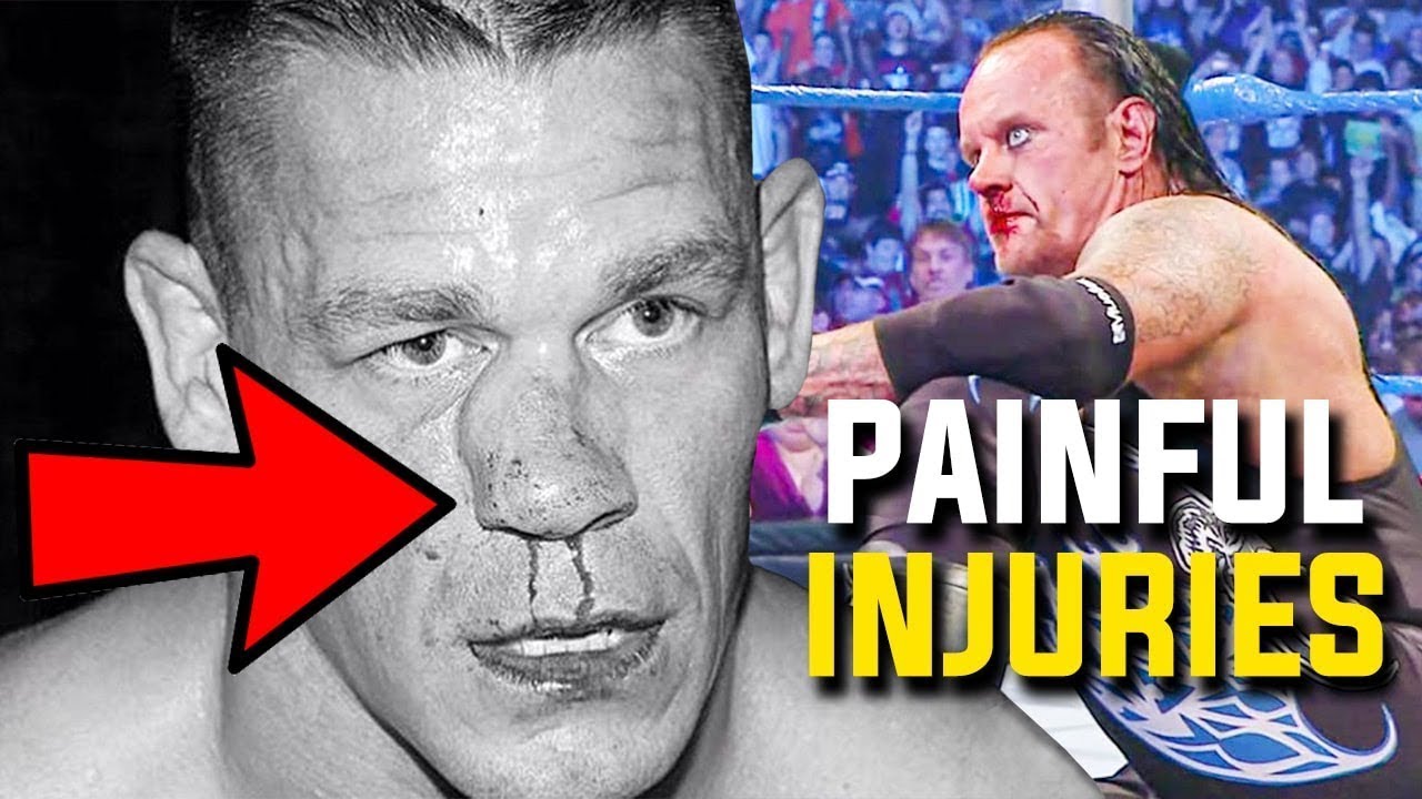 Wrestling's Most Painful Injuries in the Ring ft. John Cena WWE - YouTube