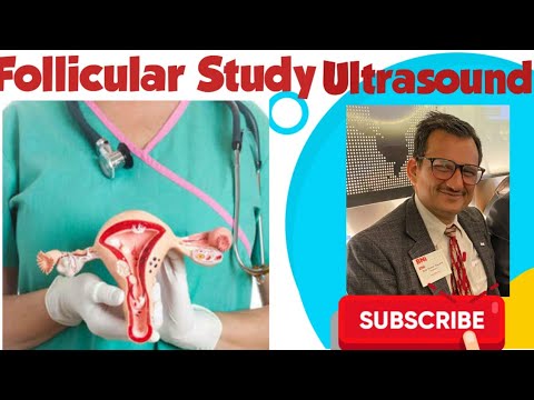 Follicular Study Ultrasound | Ovulation Study #ultrasound#ajaykaushik ...