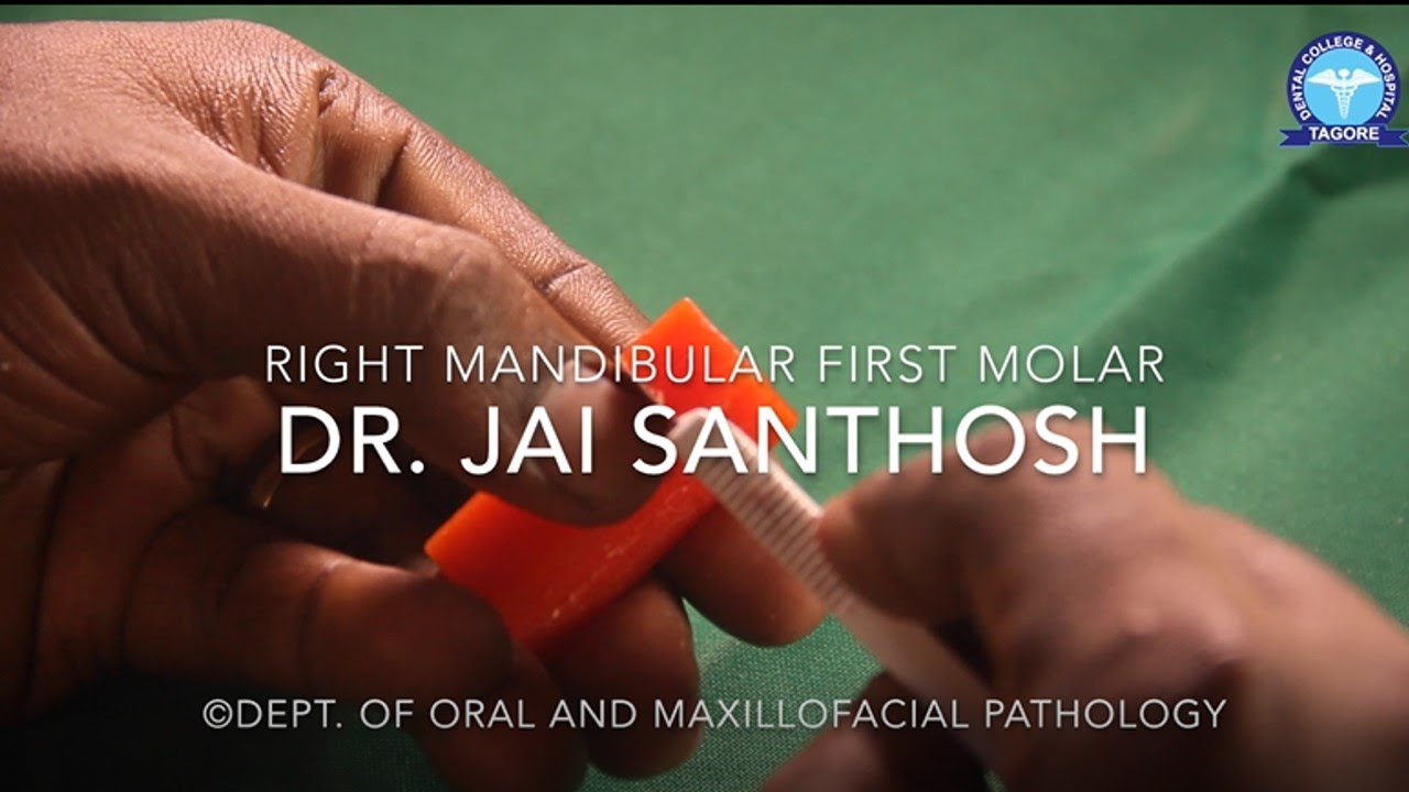 Permanent Mandibular first molar carving - Dr.V.Jai Santhosh Manikandan ...