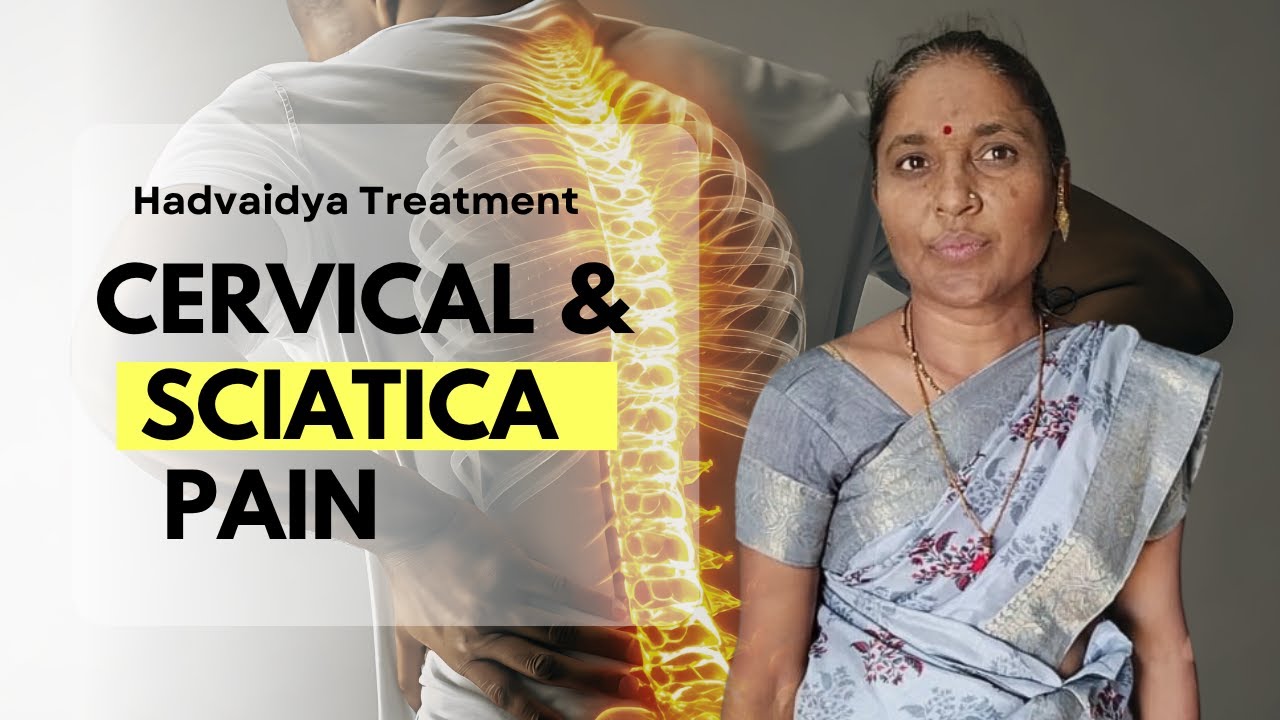 Severe Sciatica & Cervical Pain | 100% Natural Recovery | Hadvaidya ...