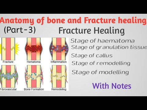 Anatomy of bone and Fracture healing (part-3) - Fracture healing - YouTube