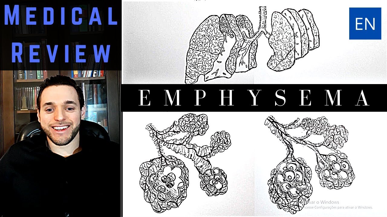 Emphysema Pathophysiology, destruction of alveolar walls and loss of ...