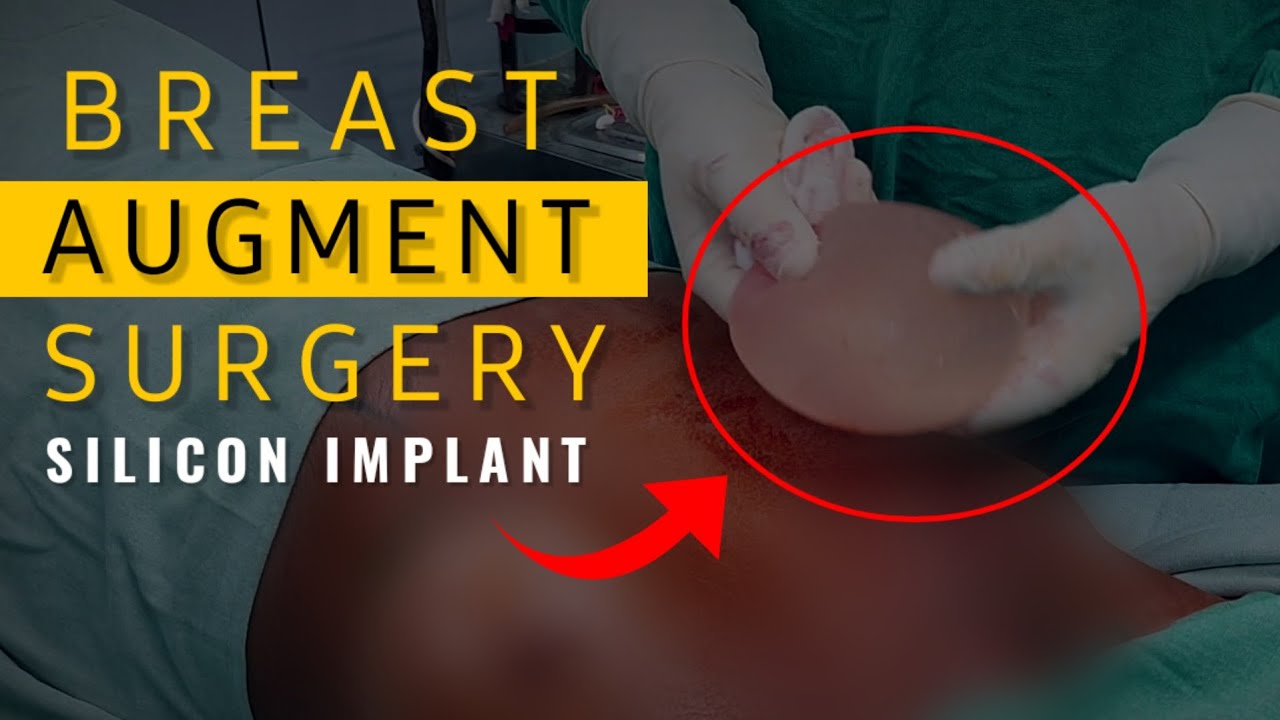 Breast Augment Surgery & 15 Days Result || Silicon implant || Dr. Jayanta Bain plastic surgeon ...