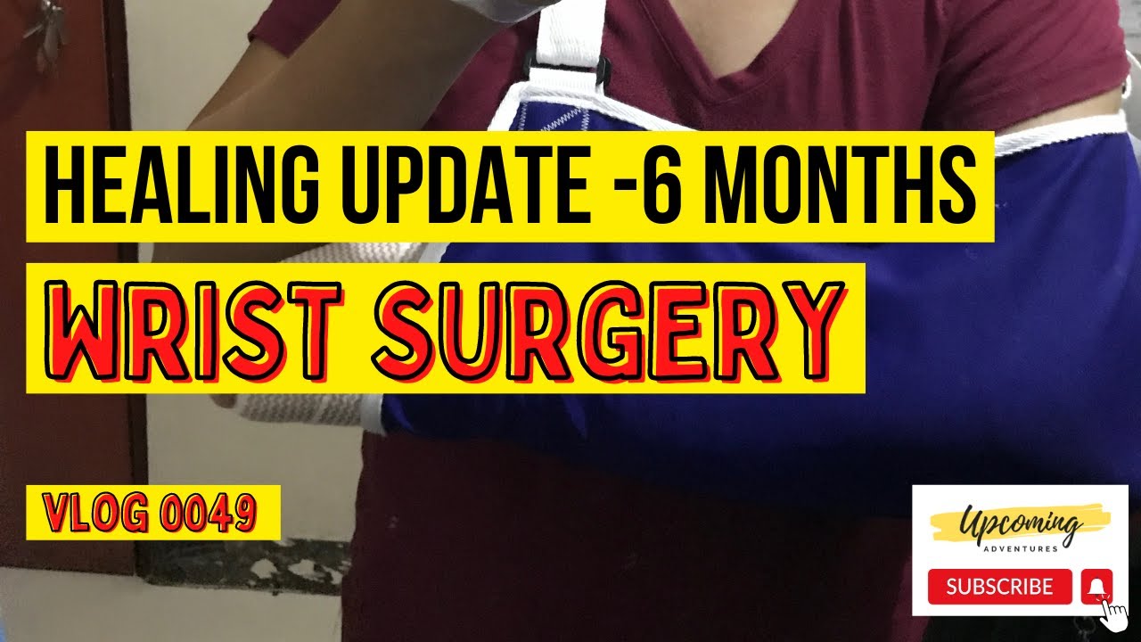 PART 2 DISTAL RADIUS WRIST FRACTURE UPDATE 6 MONTHS POST SURGERY YouTube part-2-distal-radius-wrist-fracture-update-6-months-post-surgery-youtube