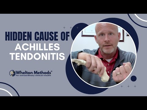 I Don’t Have Issues Rehabbing Achilles Tendonitis · Whelton Methods ...
