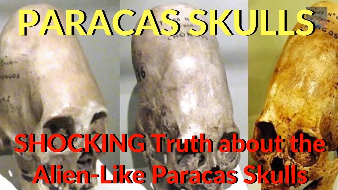 Paracas Elongated Skulls | SHOCKING Truth about the Alien-Like Paracas ...