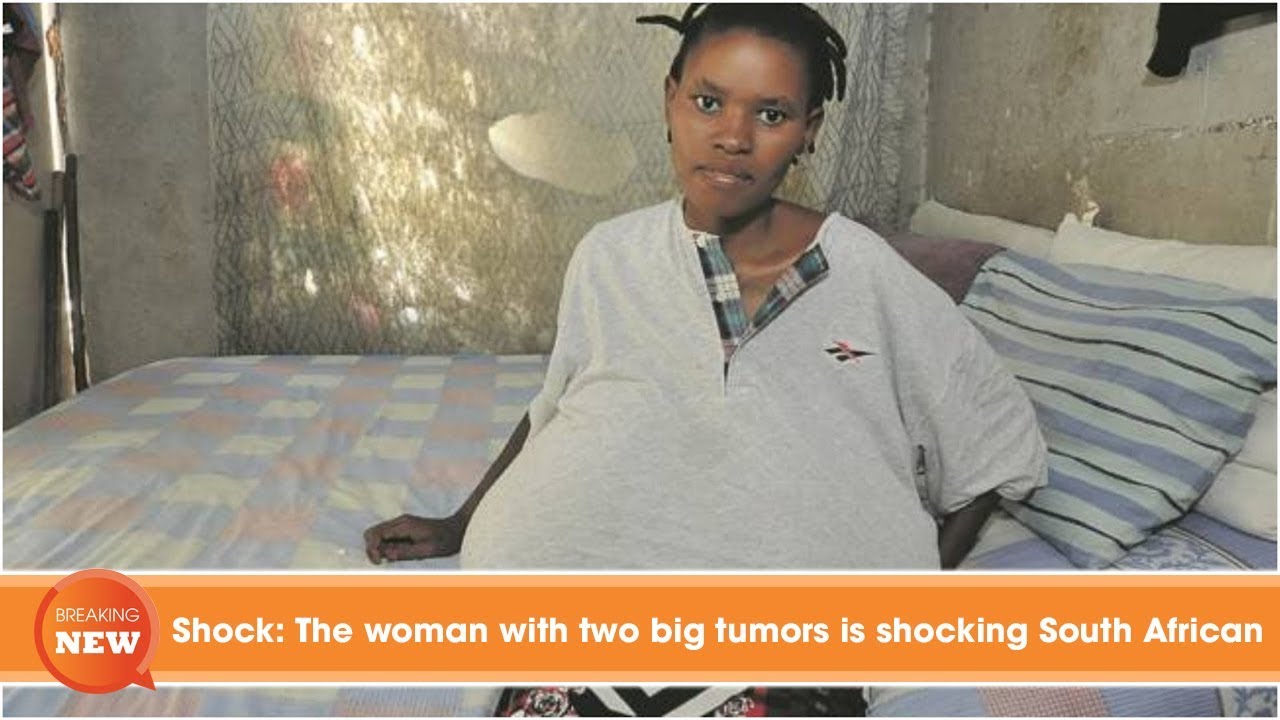 Shock: The woman with two big tumors is shocking South African - YouTube