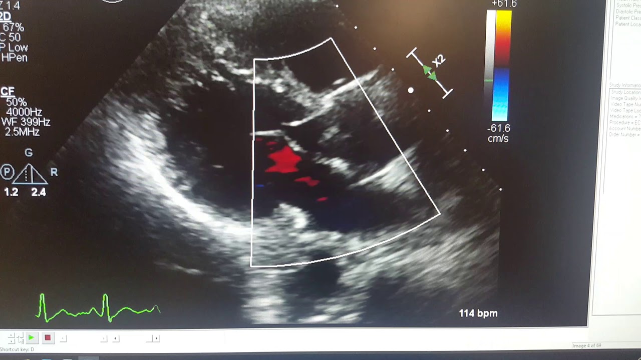 PE Color(2) - YouTube