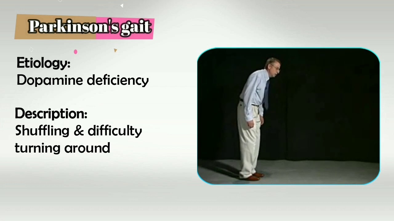 Abnormal gaits, their types and causes... - YouTube