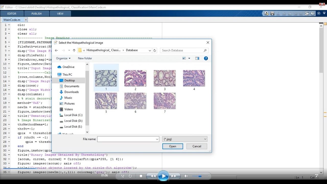 Feature Extraction Via Deep Learning For Histopathological Feature Extraction Via Deep Learning For Histopathological