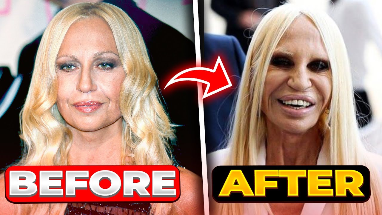TOP 15 MOST SHOCKING PLASTIC SURGERY DISASTERS | CELEBRITY ...