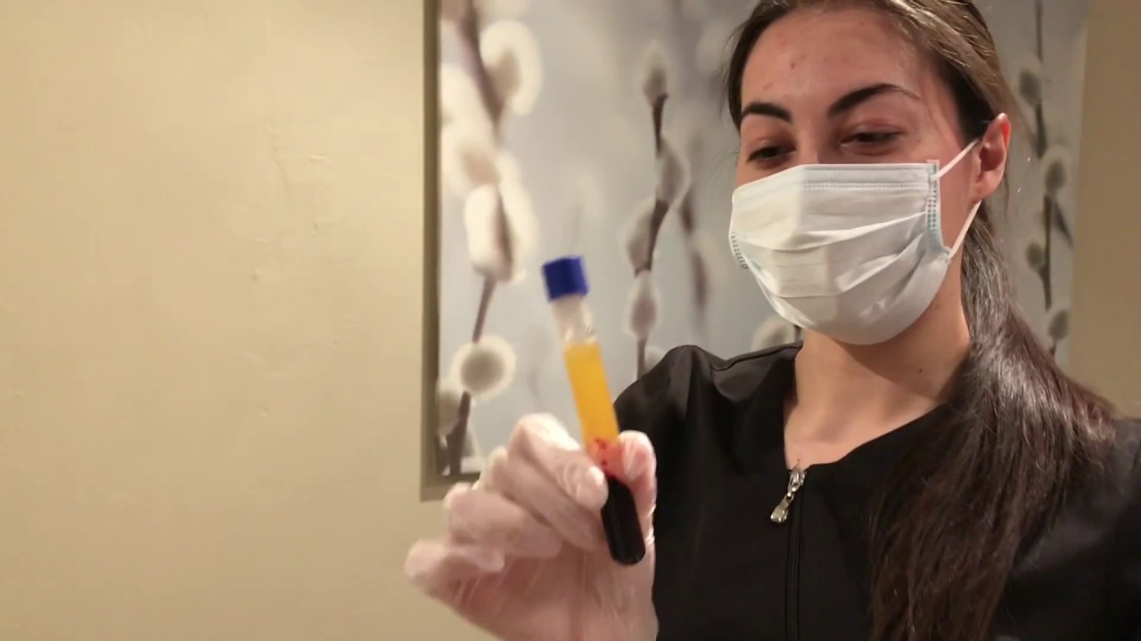 PRP for wrinkles and lines with U225 Mesotherapy - YouTube