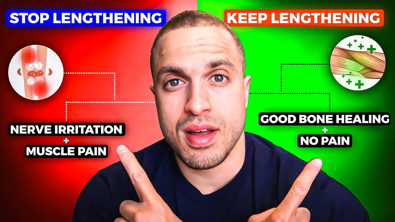 Reach your limb lengthening goal with THIS technique - YouTube