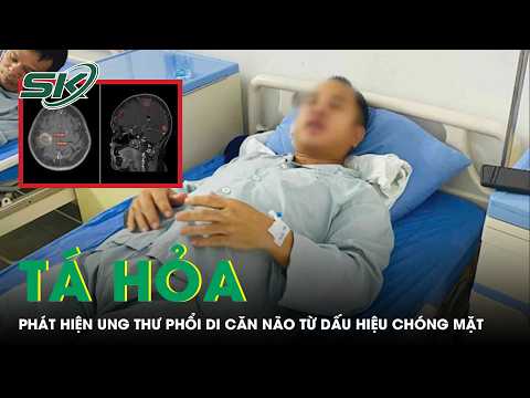 Người đàn ông tá hỏa phát hiện ung thư phổi di căn não từ dấu hiệu chóng mặt | SKĐS
