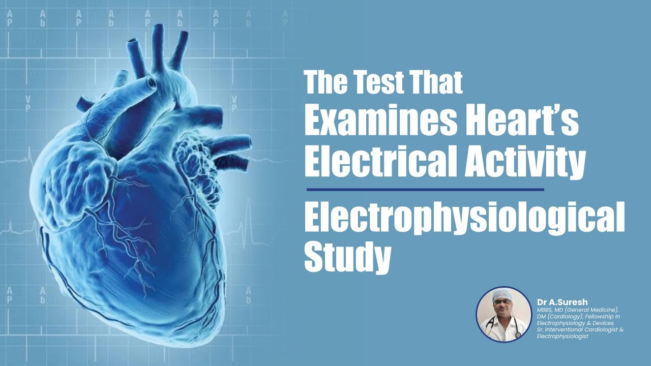 All You Need To Know About Electrophysiological Study (EP study ...