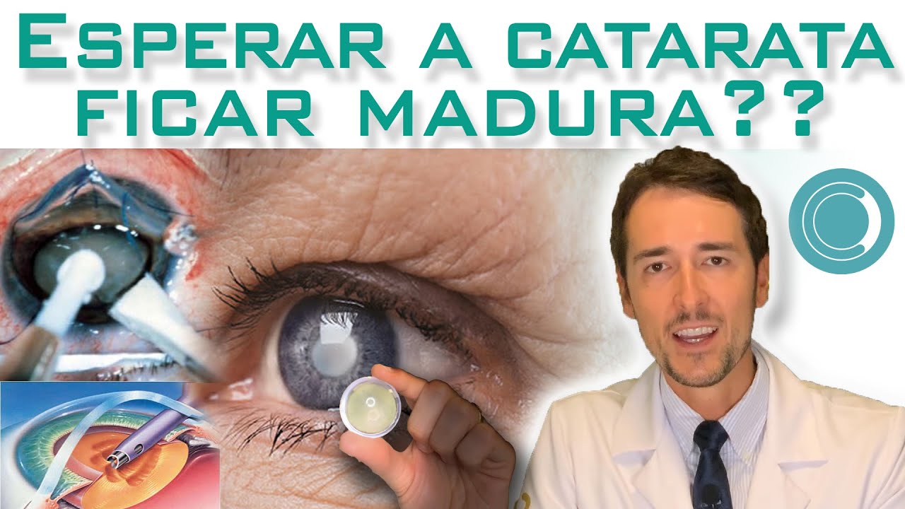 Como saber se a catarata já está madura ?? - YouTube