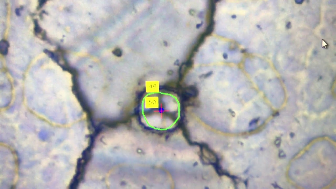 Zeiss PALM microbeam dissection - YouTube