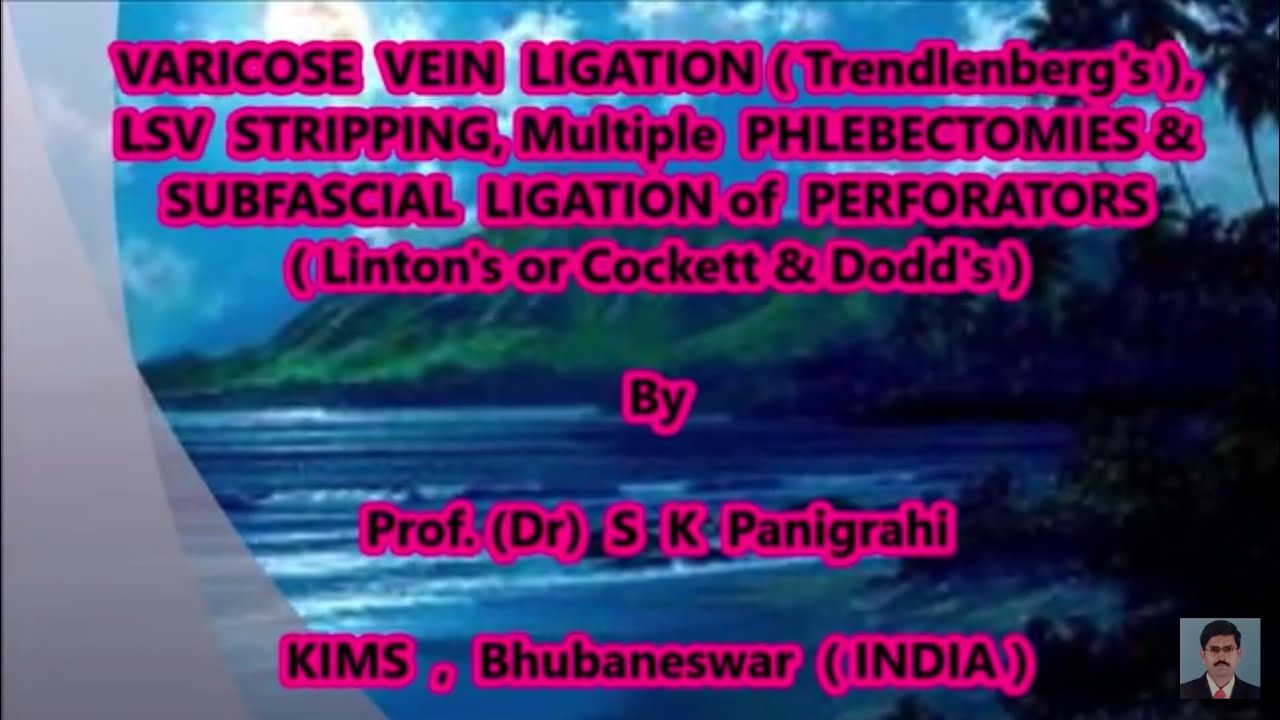 VARICOSE VEINS - LSV Ligation & Stripping, Phlebectomy & Subfascial ...