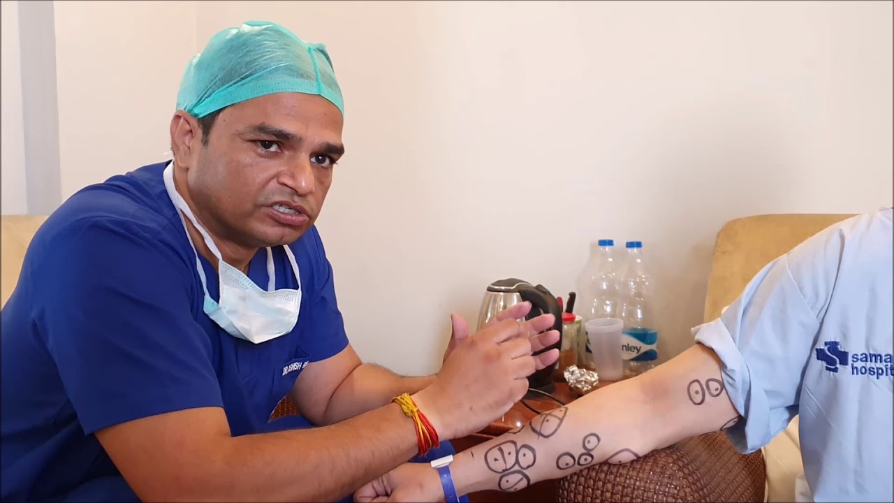 Lipolytic Lipolysis Injection Treatment for Lipoma Dr Ashish Bhanot ...