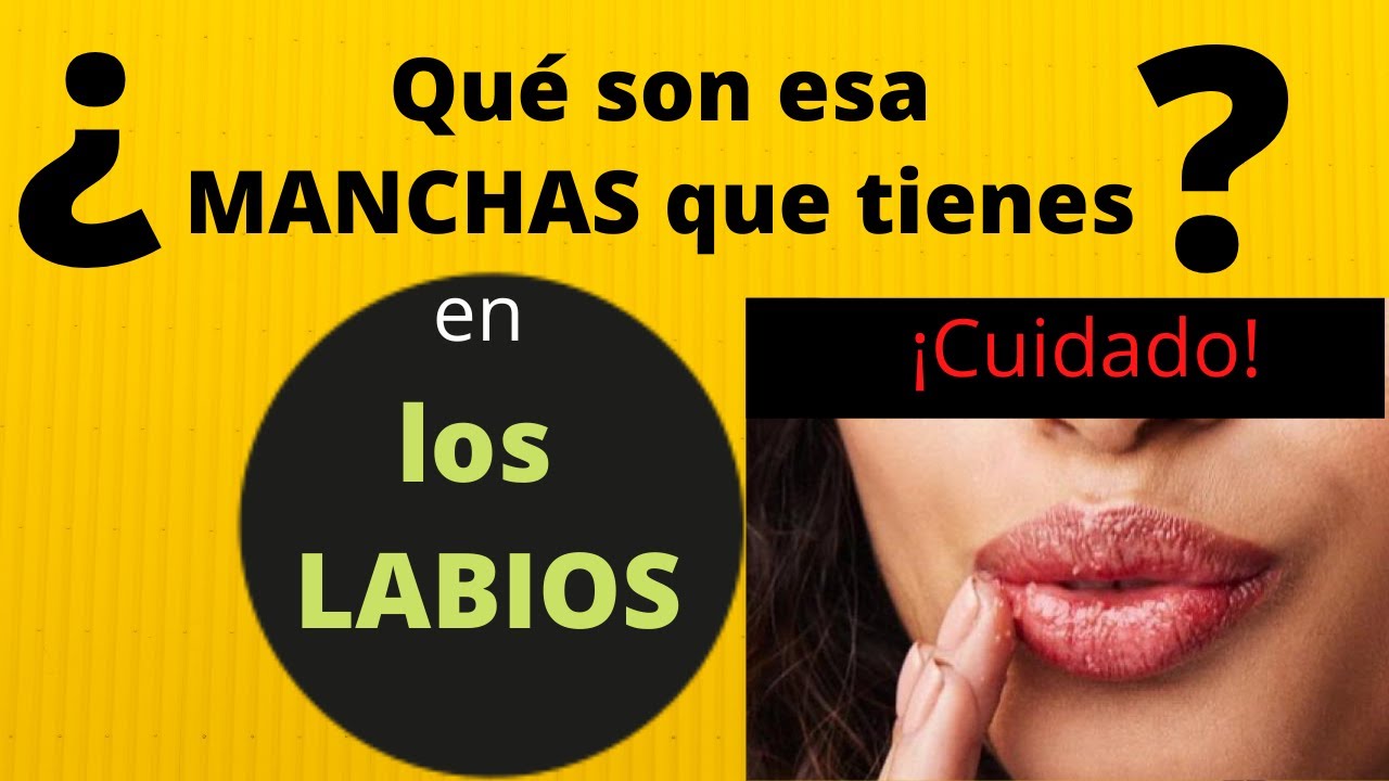 ¿Que son esas MANCHAS que tienes en los LABIOS? ¡Cuidado! Descubre aquí ...