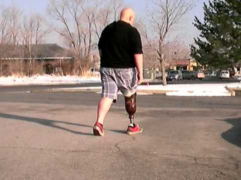 Revolimb- Dual Zone Transtibial - YouTube