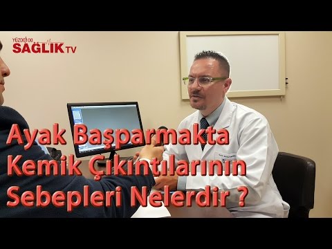 Op. Dr. Altuğ Tanrıöver - Ayak Başparmakta Kemik Çıkıntılarının Sebepleri Nelerdir ?