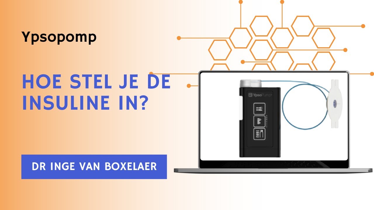 Mylife Loop Academy | Hoe stel je insuline in op de Ypsopump ...