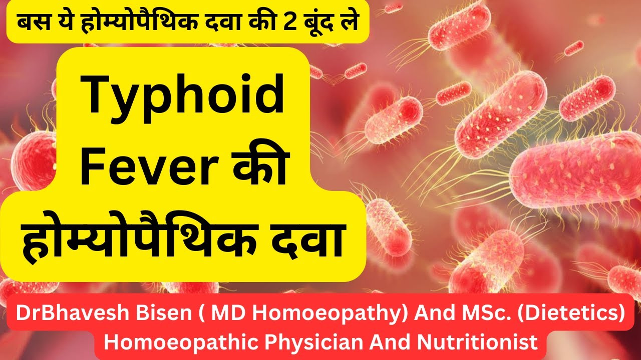 Best Homeopathic Medicine For Typhoid Fever | Typhoid Fever Treatment ...
