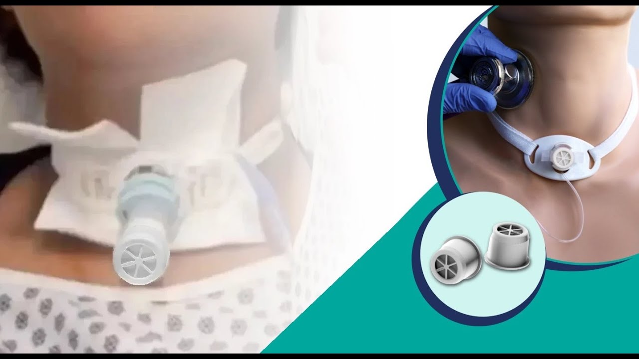 Speak Valve - YouTube