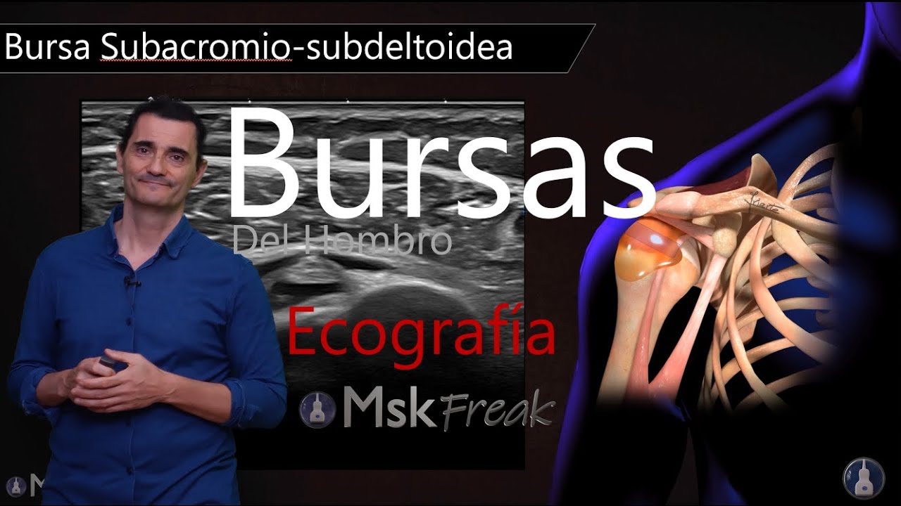 ECOGRAFÍA DE LAS BURSAS DEL HOMBRO (PARTE II) - YouTube