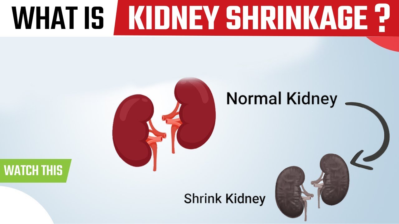What Is Kidney Shrinkage? - YouTube