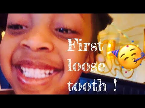 My FIRST LOOSE TOOTH ! 🥳 | Mini Vlog | Best of Maya & Riley - YouTube
