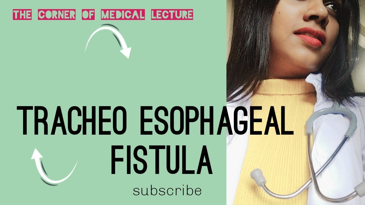 TEF ( TRACHEO ESOPHAGEAL FISTULA) //// Child Health Nursing - YouTube
