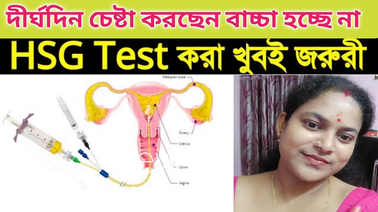 HSG ( Hysterosalpingography )hsg test experience l HSG টেস্ট কেন করা ...