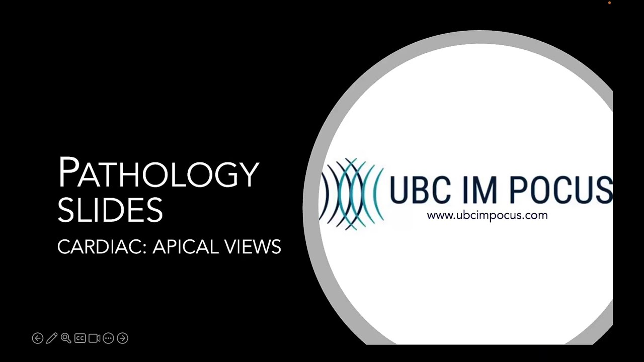 POCUS Pathology: Cardiac - Apical Views - YouTube
