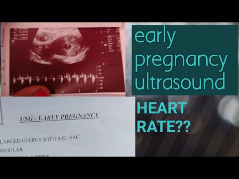 How to read 6 weeks early pregnancy ultrasound report//FHR,YOLK SAC ...