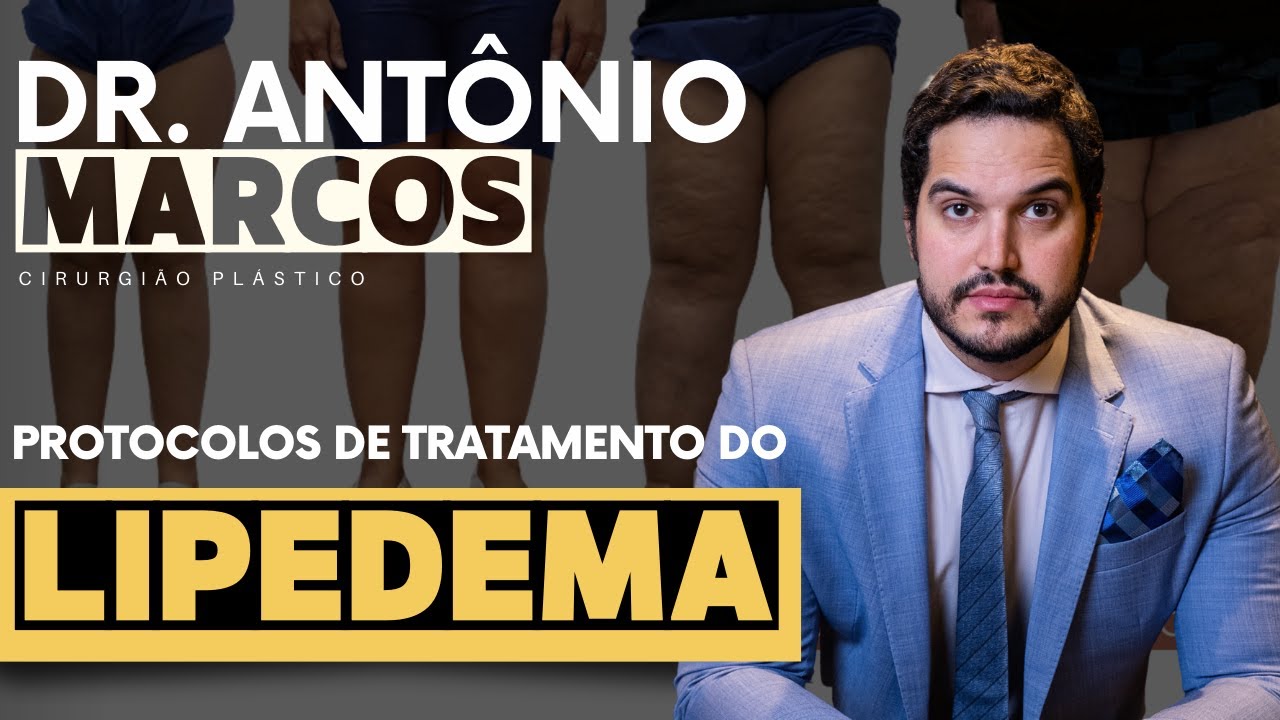 CONHEÇA O TRATAMENTO PARA O LIPEDEMA | Dr. Antônio Marcos - YouTube