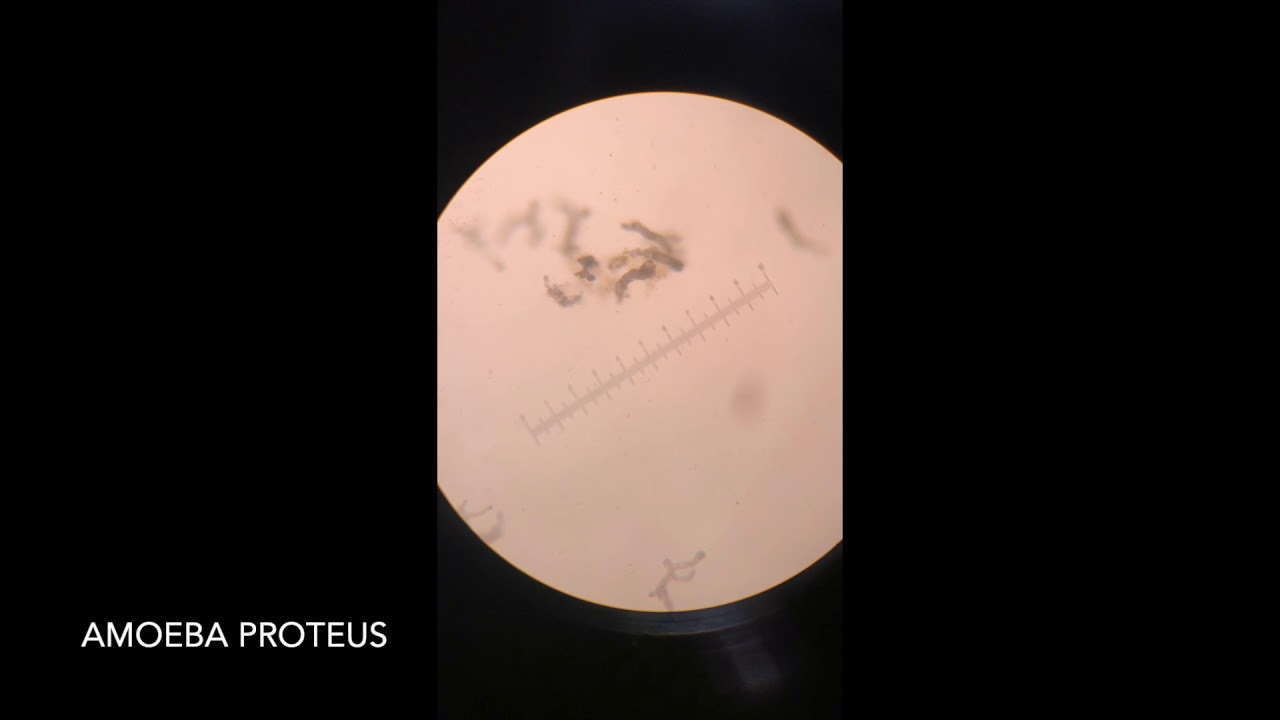 Amoeba proteus under microscope - YouTube