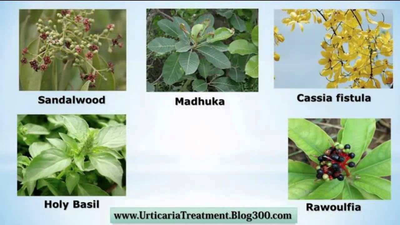 Cholinergic Urticaria Treatment Chronic Idiopathic Urticaria