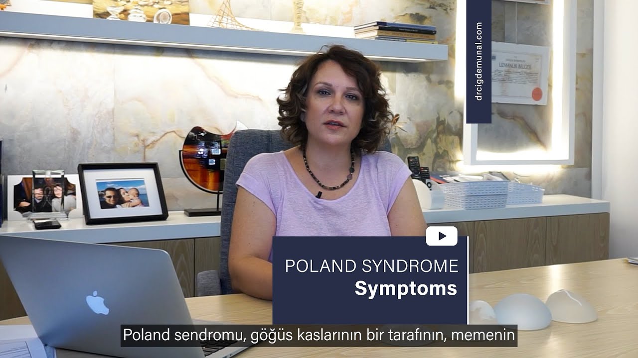 Poland's Syndrome - YouTube