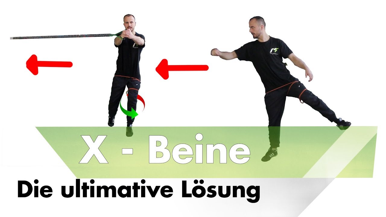 Die ultimative Übung gegen X - Beine | Komplette Muskelkette - YouTube