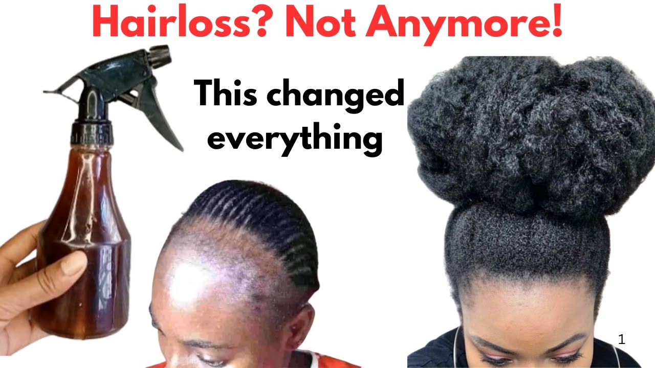 So Many People Have Used This ONE INGREDIENT To Grow Back Their Edges ...