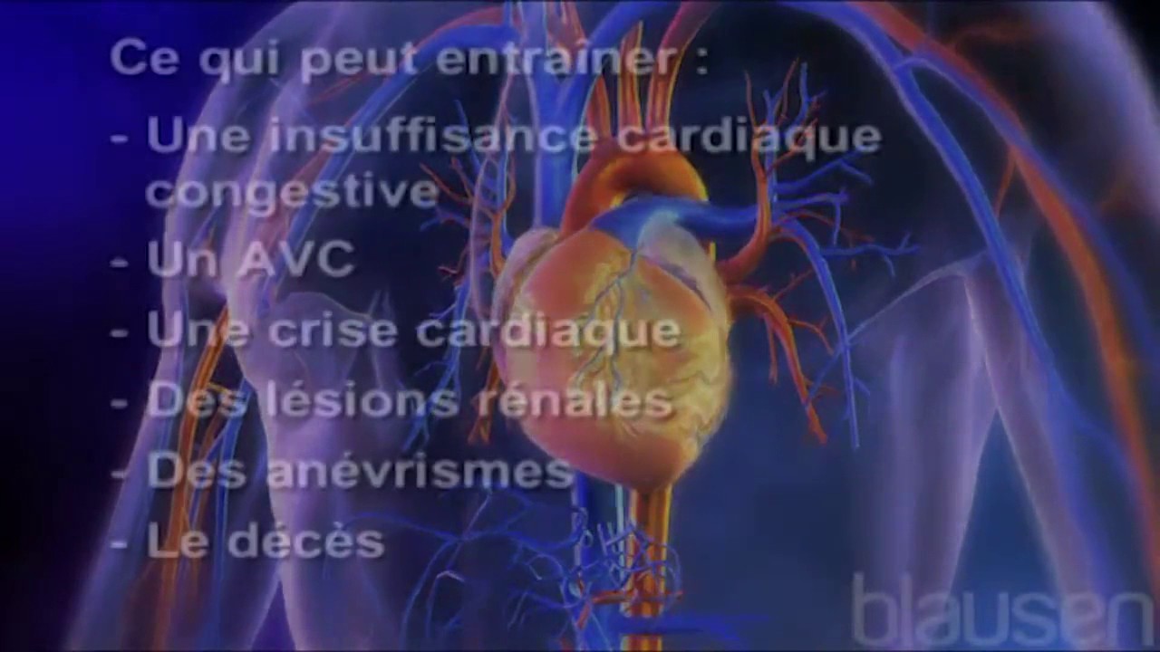 Alphabloquants - YouTube