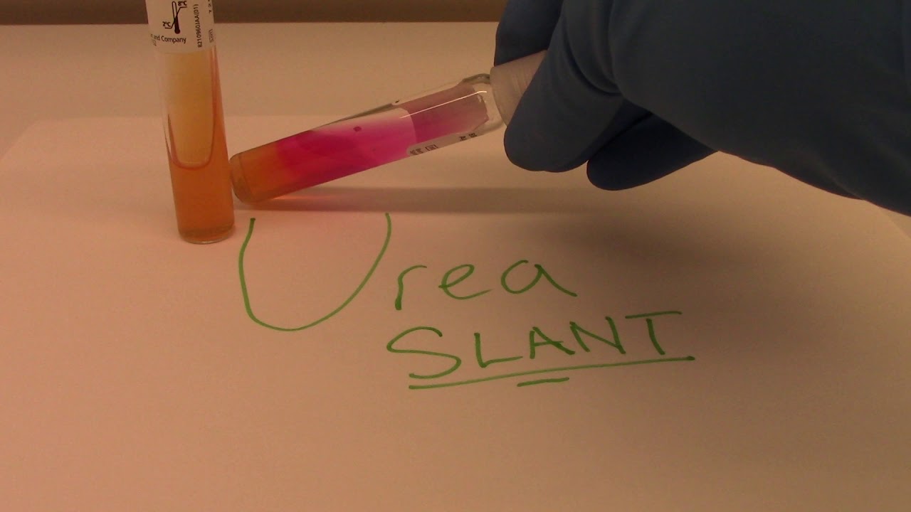 Urea Test - Part 2 - YouTube