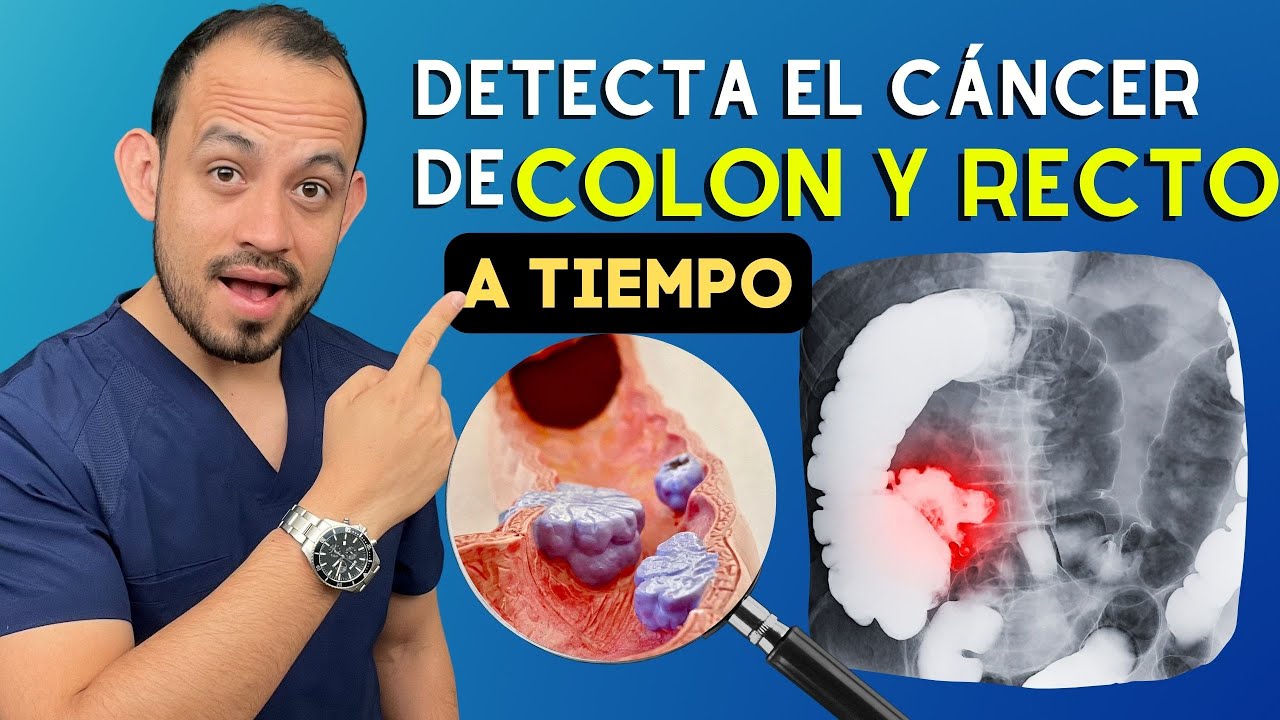 Estudios para DETECTAR el Cáncer de Colon y Recto (Tamizaje) 2025 - YouTube
